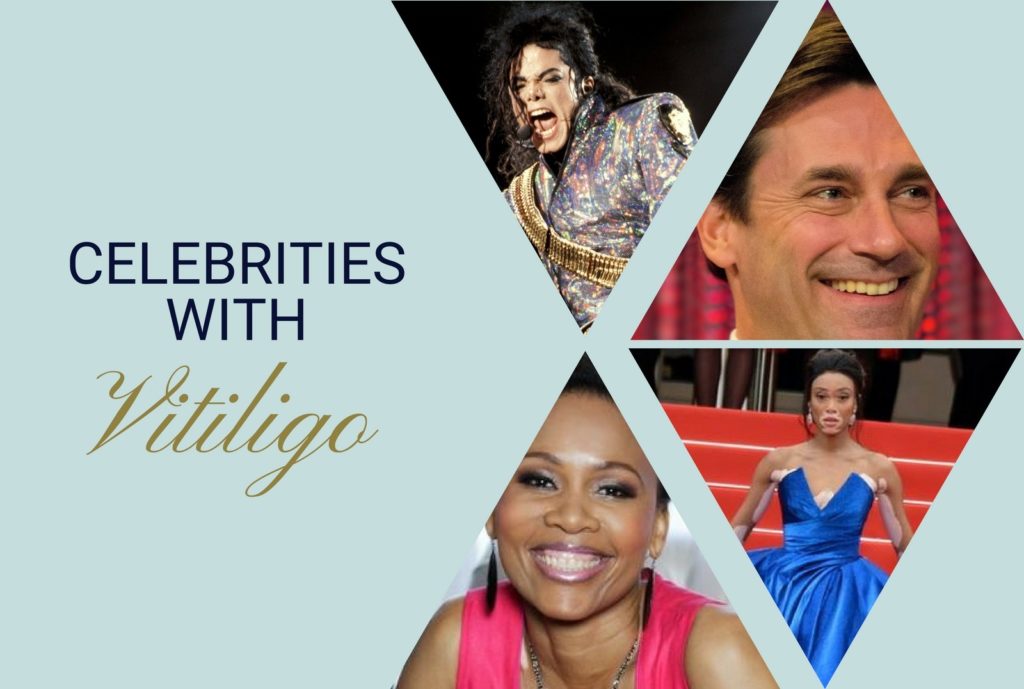 Famous Vitiligans – 56 Celebrities with Vitiligo – Unite For Vitiligo