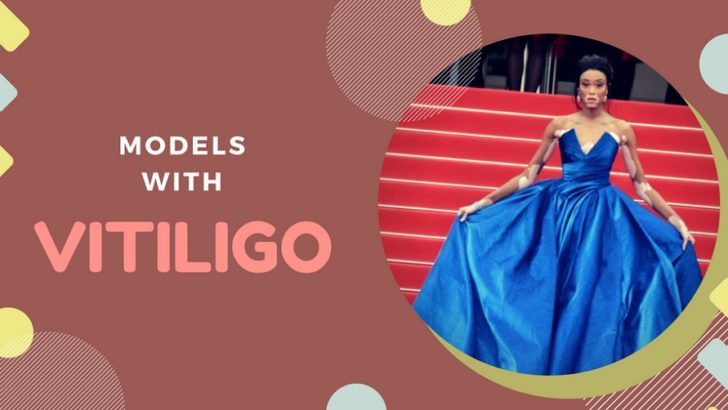 Vitiligo Friendly Advertising – How far have we come? – Unite For Vitiligo