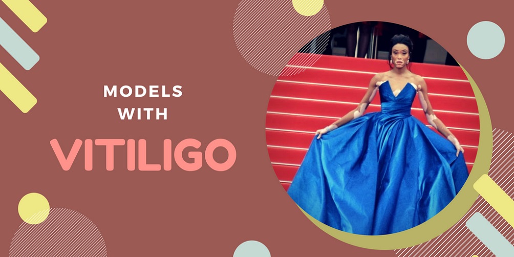 Outshining Vitiligo – 31 Famous Models with Vitiligo – Unite For Vitiligo