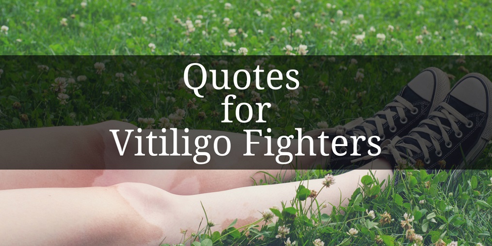 5 Empowering Quotes to motivate Vitiligo Fighters – Unite For Vitiligo