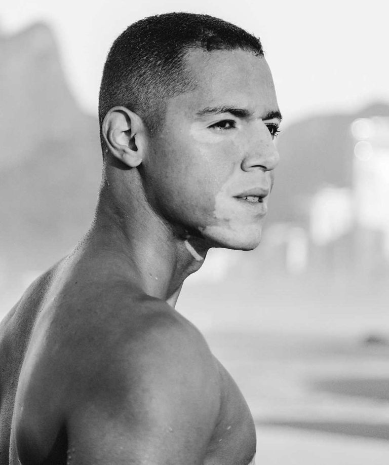 10 Most Attractive Vitiligans (2018) – Men – Unite For Vitiligo