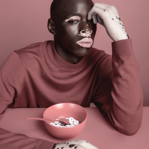 10 Most Attractive Vitiligans (2019) – Men – Unite For Vitiligo