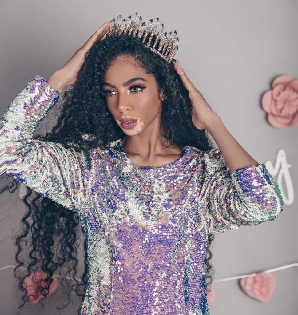 10 Most Influential Vitiligans | 2020 – Unite For Vitiligo