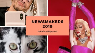 Outshining Vitiligo – 31 Famous Models with Vitiligo – Unite For Vitiligo