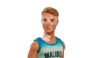 Unite For Vitiligo - An Interactive Platform for Vitiligo Fighters